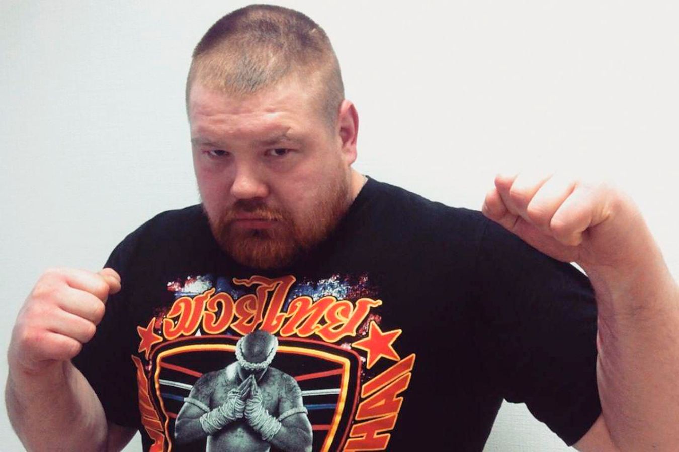 Дацик показал перелом, полученный в бою с Шульским. Фото - Чемпионат